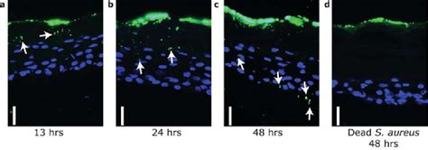 Figure 2 From Staphylococcus Aureus Exploits Epidermal Barrier Defects In Atopic Dermatitis To