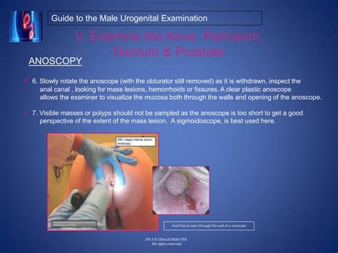 A Guide To The Clinical Male Urogenital Examination Pptx Sexual Conditions Sexual Health