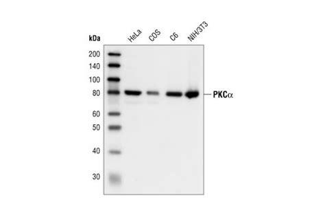 Pkc Isoform Antibody Sampler Kit Cell Signaling Technology
