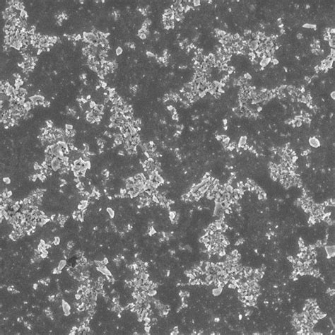 Fractogram Of Elution Of Submicron Particle Fraction Download