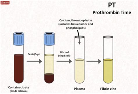 Intraoperative Coagulation Monitoring Flashcards Quizlet