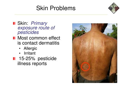 Ppt The Long Term Effects Of Pesticide Exposure On Human Health An