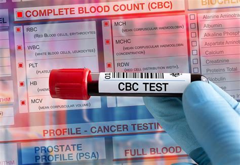 How Much Does An Std Test Cost With Insurance Livewell