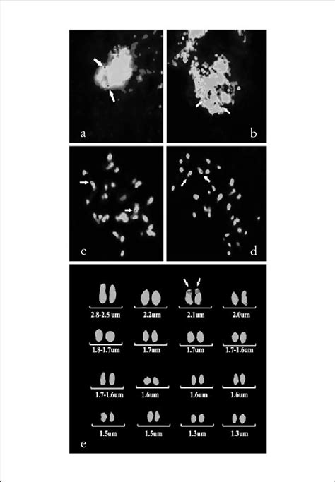 Localization Of AmA1 Sequence In A Hypochondriacus A On Interphase