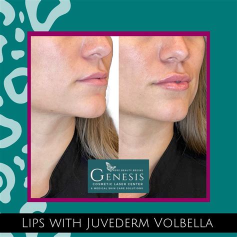 🤍 Love This Genesis Cosmetic Laser Center Florence