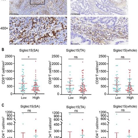 Relationship Between Siglec15 Expression And The Infiltration Of