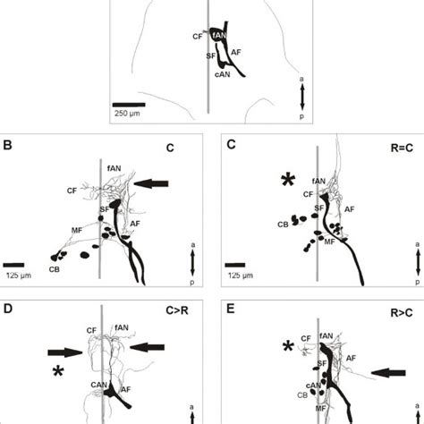 Schematic Drawings Of The Auditory Projection Within The Metathoracic