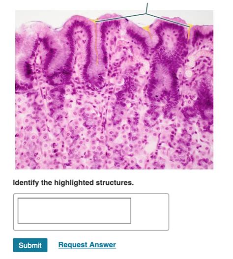 Solved Identify The Highlighted Structures Submit Request