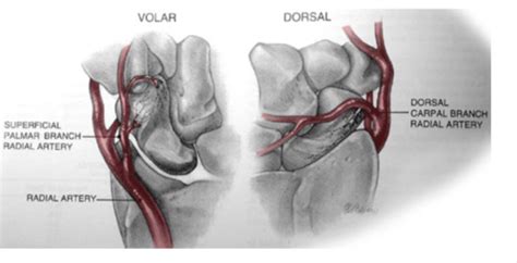 Scaphoid Fracture Flashcards Quizlet