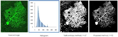 Entropic Segmentation For A Brain Cell Image With A Spatial Noise