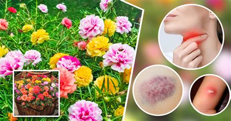 ផ្កាម៉ោងដប់ មិនមែនជារុក្ខជាតិធម្មតាទេ តែមានអត្ថប្រយោជន៍ច្រើនស្ទើរតែមិនគួរឱ្យជឿ Khmerload