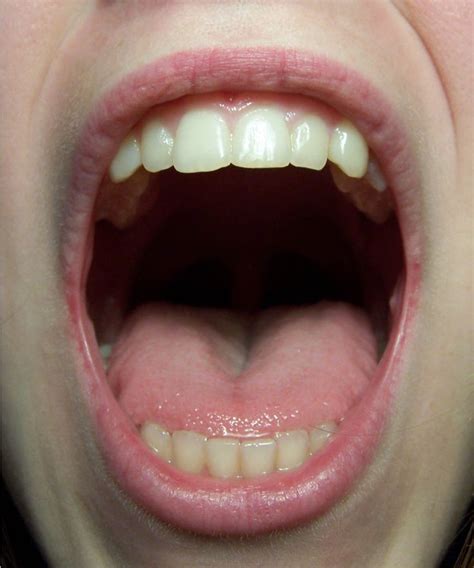 Mouth Detail Front By Della Stock On Deviantart Beautiful Teeth