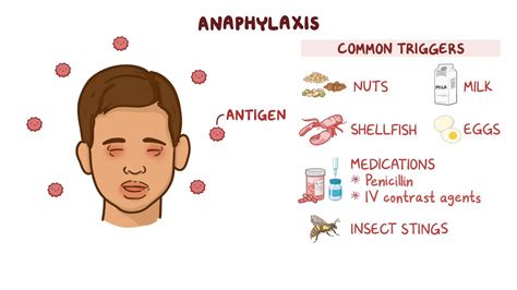 Anaphylaxis Shock