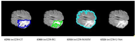 Biomedical Image Segmentation