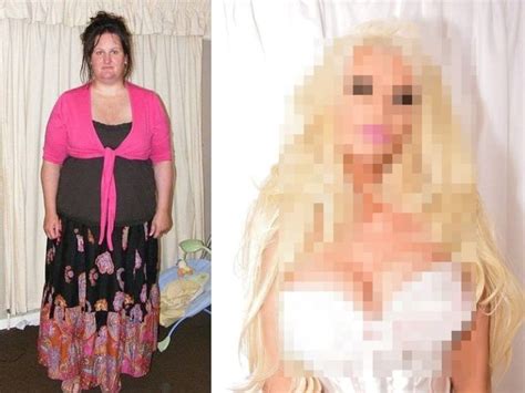 【驚愕】デブ＋ブサイク女性が90kg痩せて100万円で全身整形 ⇒ 結果（画像あり） ポッカキット