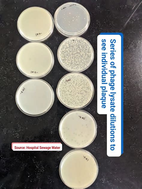Priyanka Upadhyay On Linkedin Sharing Double Layer Agar Dla Method For Isolation Of Individual…