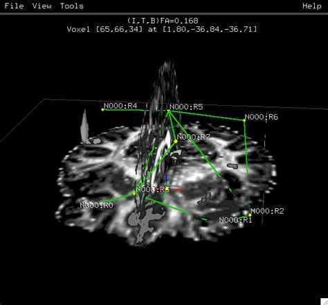 62 Suma Viewer — Afni Suma And Fatcat V25212