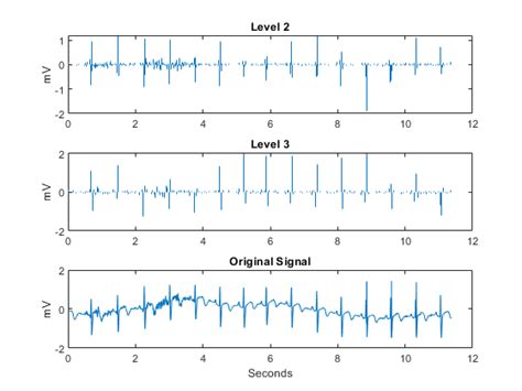 Dual Tree Complex Wavelet Transforms Matlab And Simulink