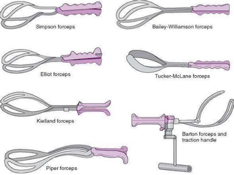 Forceps Delivery Pptx