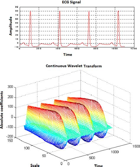 Pdf Audio Signal Denoising Using Wavelets Algorithm In Matlab And