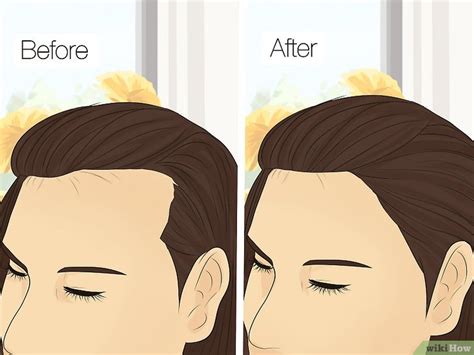 10 Effective Ways To Hide Thinning Hair In The Front For Women