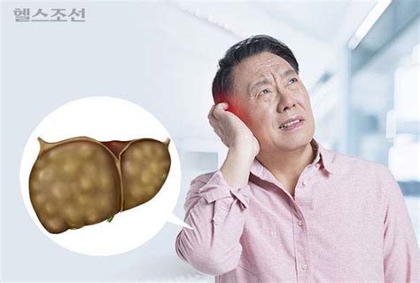 지방간 환자 돌발성 난청 위험 커 당신의 건강가이드 헬스조선