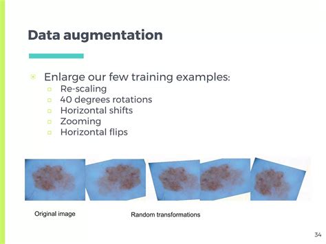 Skin Lesion Detection From Dermoscopic Images Using Convolutional