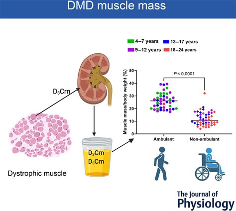Reductions In Functional Muscle Mass And Ability To Ambulate In