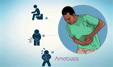 Amebiasis Symptoms Diagnostic Test And Treatment Webofmedical On Tumblr