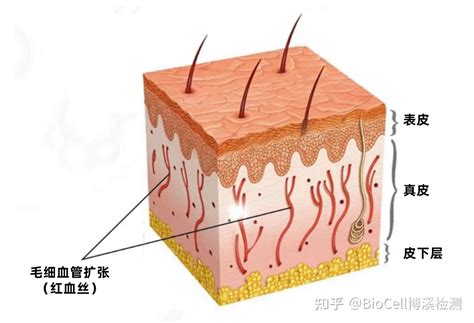 舒缓功效之“褪红力”的创新测评体系 知乎