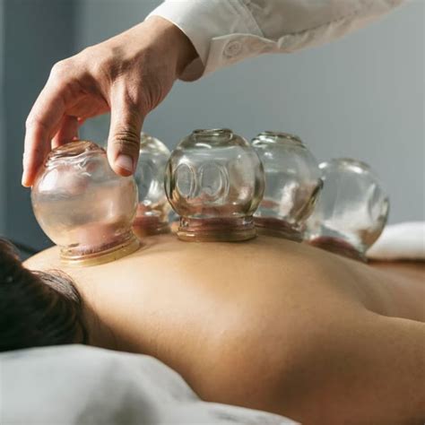 Cupping Therapy Summerlin Dynamic Spine And Sport Rehabilitation