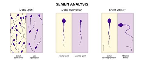 Semen Analysis Fertility Centers Of Illinois