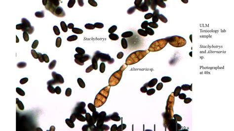 Toxicology Toxicology Asbestos And Mold Analysis Lab