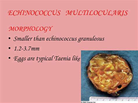 Echinococcus Granulosus Egg Morphology