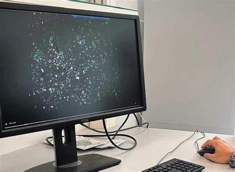 Spatial Temporal Detection Of Apoptotic Cell Death In Live Cell Imaging
