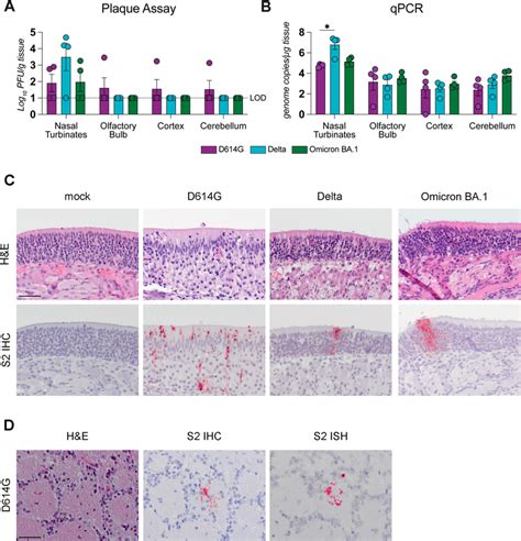 Sars Cov 2 In Nasal Turbinates Olfactory Bulb Cerebral Cortex And