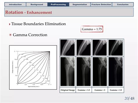Master Thesis Long Bone Segmentation And Fracture Detection In X Ray