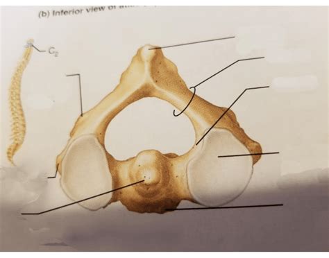 Axix C2 Seperior View Quiz
