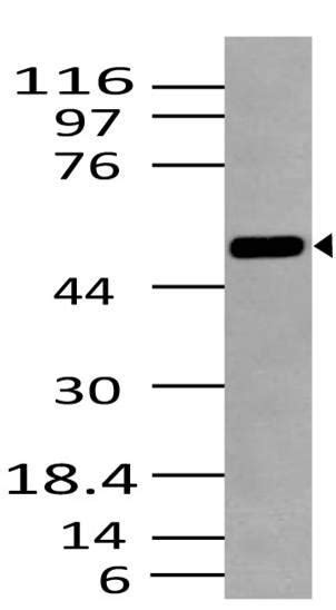 Anti Sgk1 Antibody 11 4062