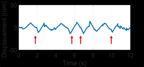 Displacement Due Incorrect Breathing And Eyes Blinking During It Is