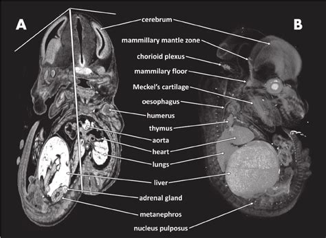 Organ And Tissue Specific Voxel Intensities Of Mouse Embryo Stage Download Scientific Diagram