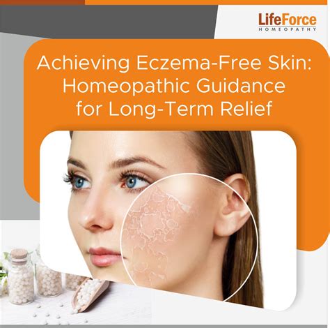 Eczema Free Skin Long Term Relief With Homeopathy Blog