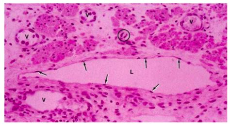 Anatomy Lymphatic System Histology Flashcards Quizlet