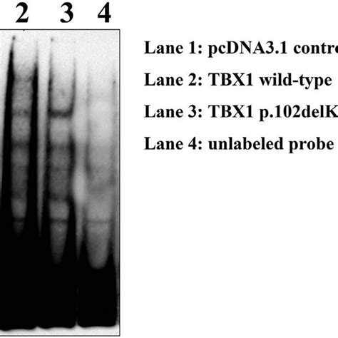 Subcellular Localization Of Wild Type And Mutant Tbx1 In Transiently
