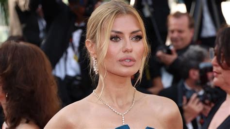 Виктория Боня наконец полностью показала лицо спустя два с половиной месяца после операции