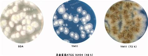 YM11琼脂培养基的原理和使用方法