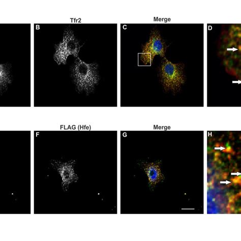 Co Localization Of Hfe And Tfr1 Confocal Analysis Was Performed To Download Scientific Diagram