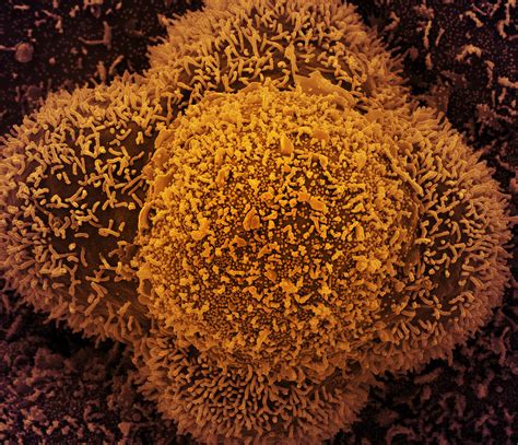 Nih Researchers Identify Potential New Antiviral Drug For Covid 19