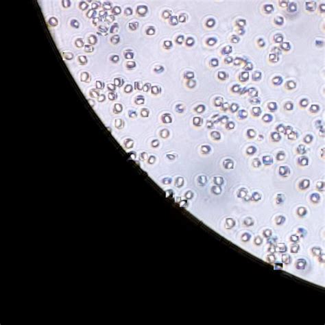 RBC Platelet Segmentation V Object Detection Dataset And Pre Trained Model By ADSYS