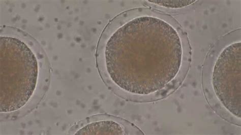 Sperm Egg Microscope